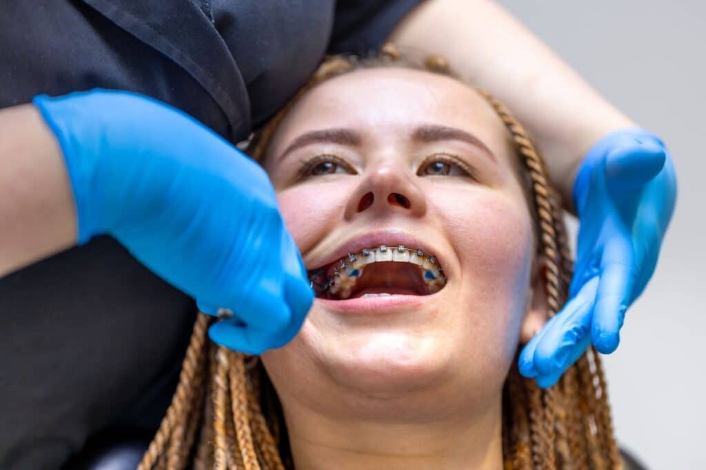 How Braces Can Change Your Face Shape: Fact or Myth?